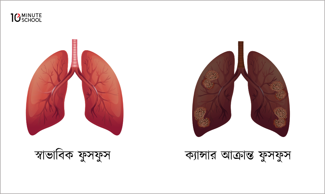 মানব শারীরতত্ত্ব: শ্বসন ও শ্বাসক্রিয়া |Human Physiology: Respiration
